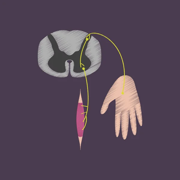 Reflex Arc Infographic Diagram Example Polysynaptic Reflex Human Hand