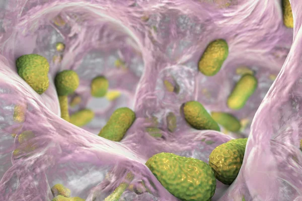 Bacteria Acinetobacter baumannii dentro del biofilm: fotografía de ... Bacteria Acinetobacter baumannii dentro del biofilm: fotografía de ...