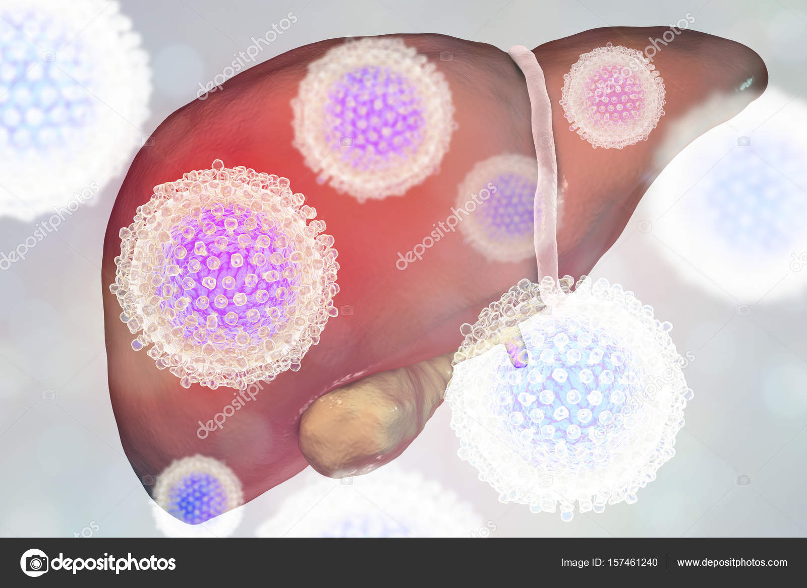 Liver with Hepatitis C infection and close-up view of Hepatitis C Virus ...