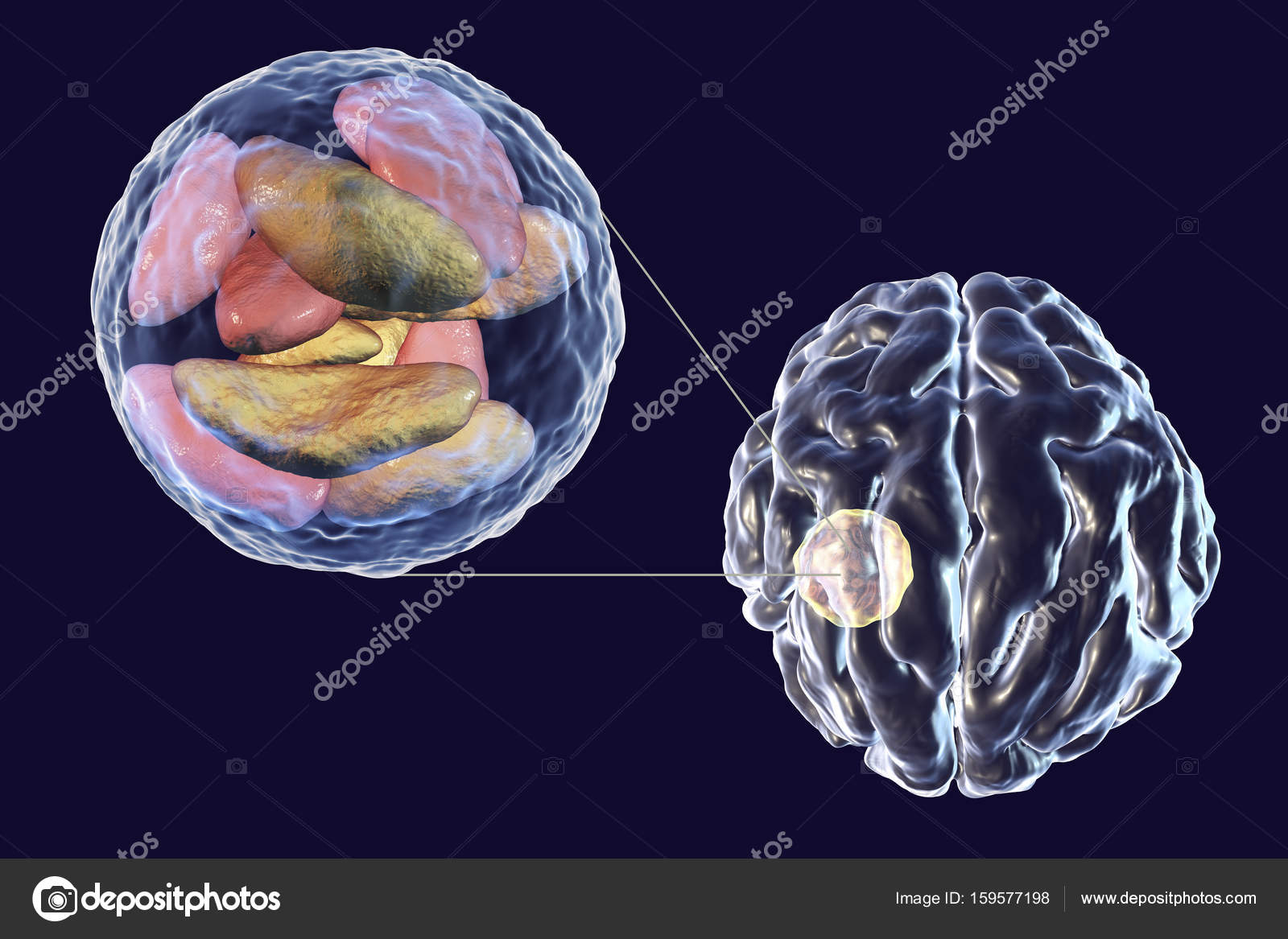 Parasites In Human Brain