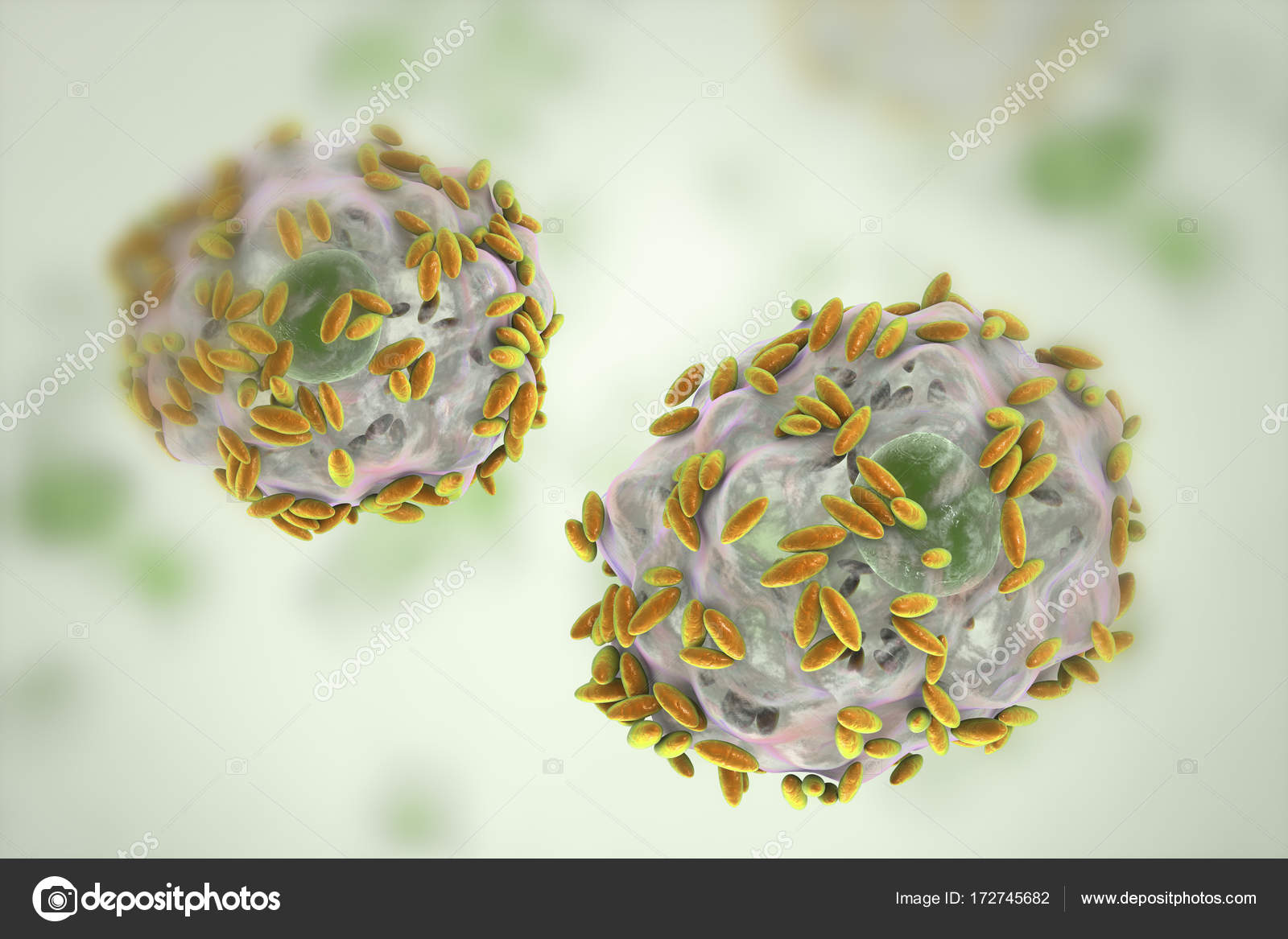 Microscopic diagnosis of bacterial vaginosis. Epithelial cell, so ...