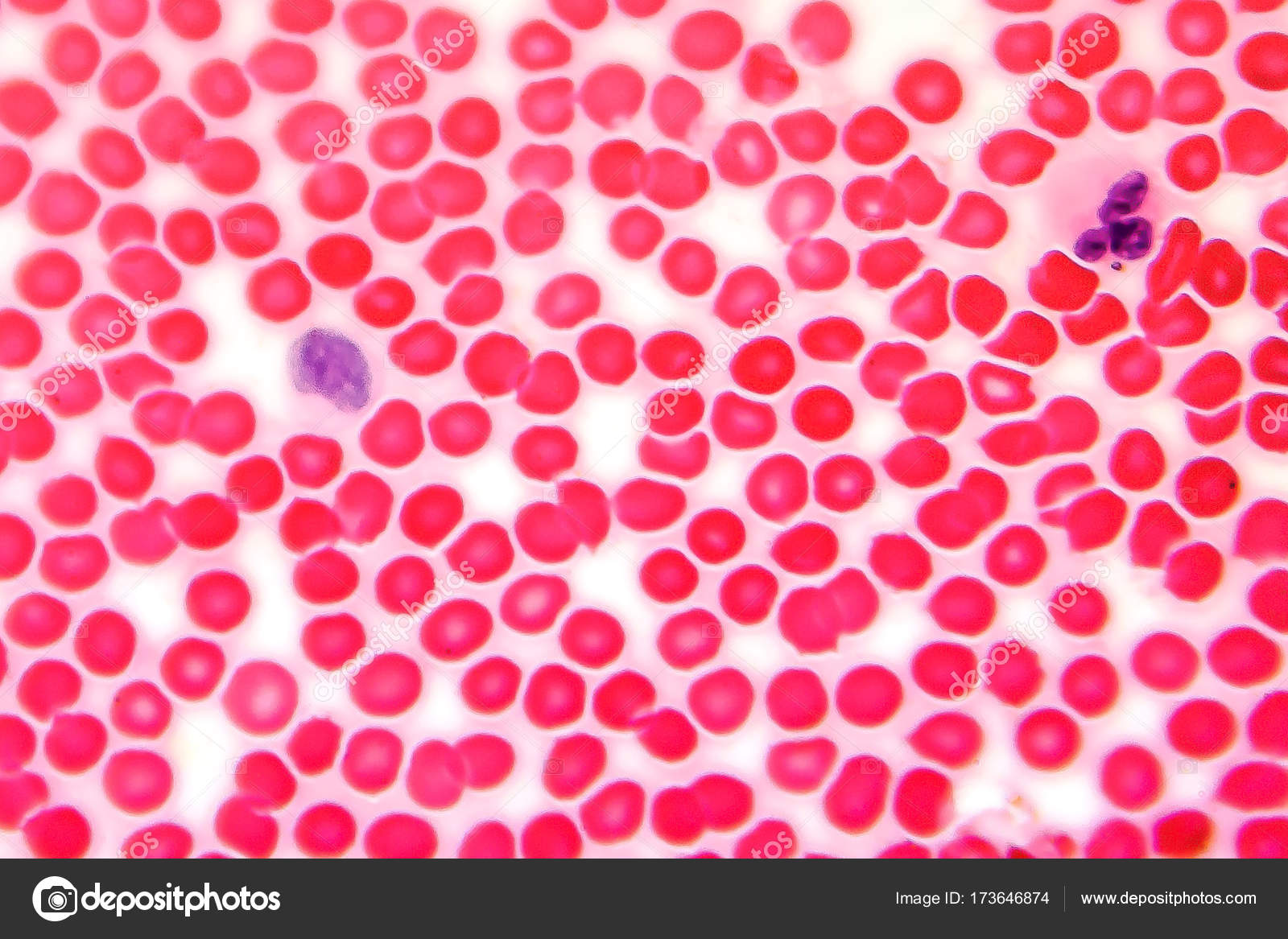 Frotis de sangre humana bajo el microscopio: fotografía de stock ...
