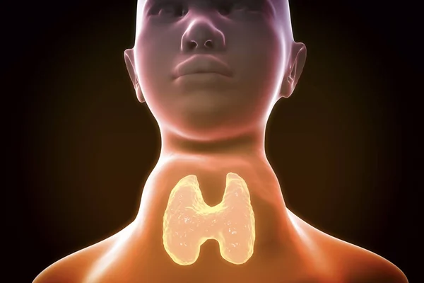 Toxic diffuse goiter, hyperthyroidism — Stock Photo © katerynakon ...