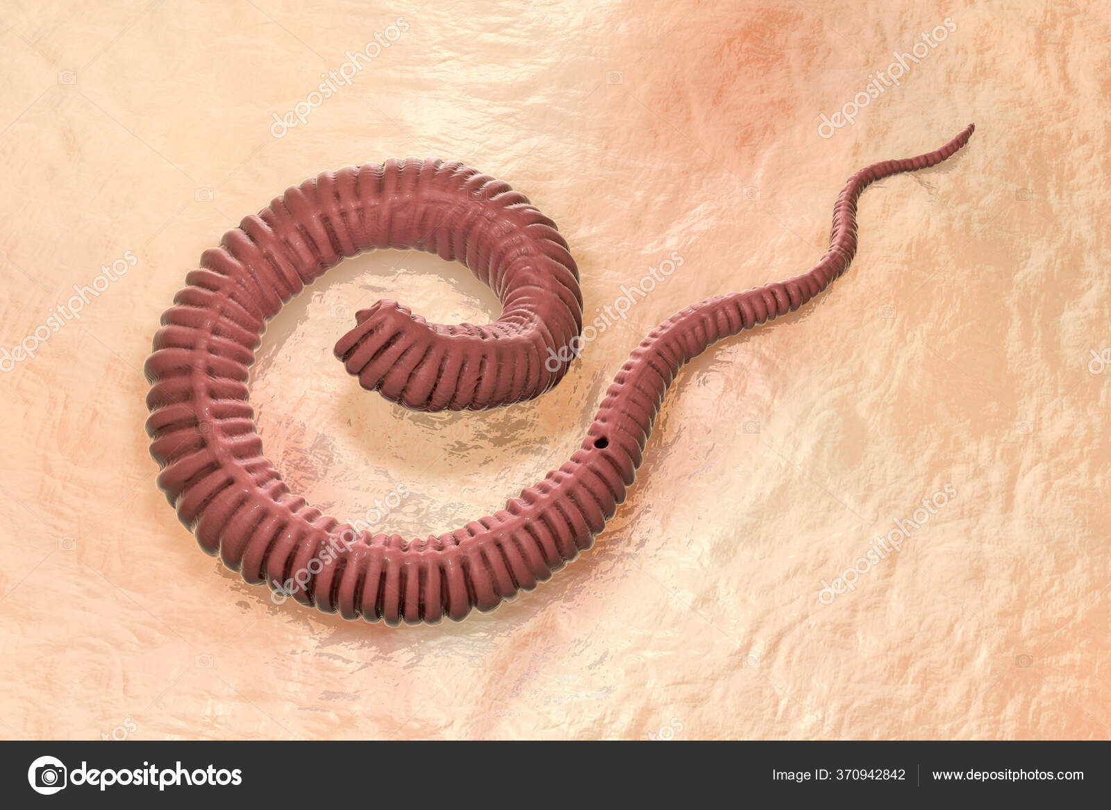 Dracunculus Medinensis Guinea Worm First Stage Larva Illustration ...