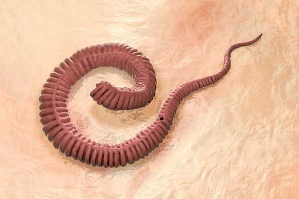 Guinea worm Stock Photos, Royalty Free Guinea worm Images | Depositphotos