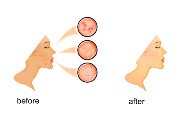 274 Exfoliate Vector Images | Depositphotos