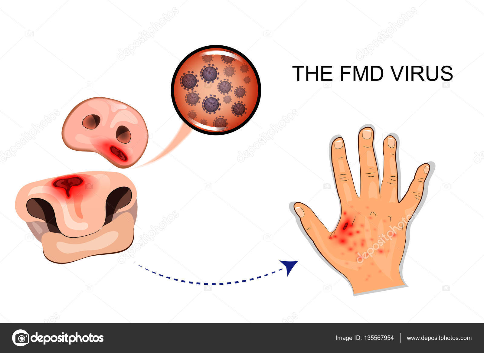 Illustration Of The Fmd Virus And Its Transmission — Stock Vector © Artemida Psy 135567954