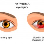 Diagram showing parts of human eye Stock Vector Image by ©blueringmedia ...