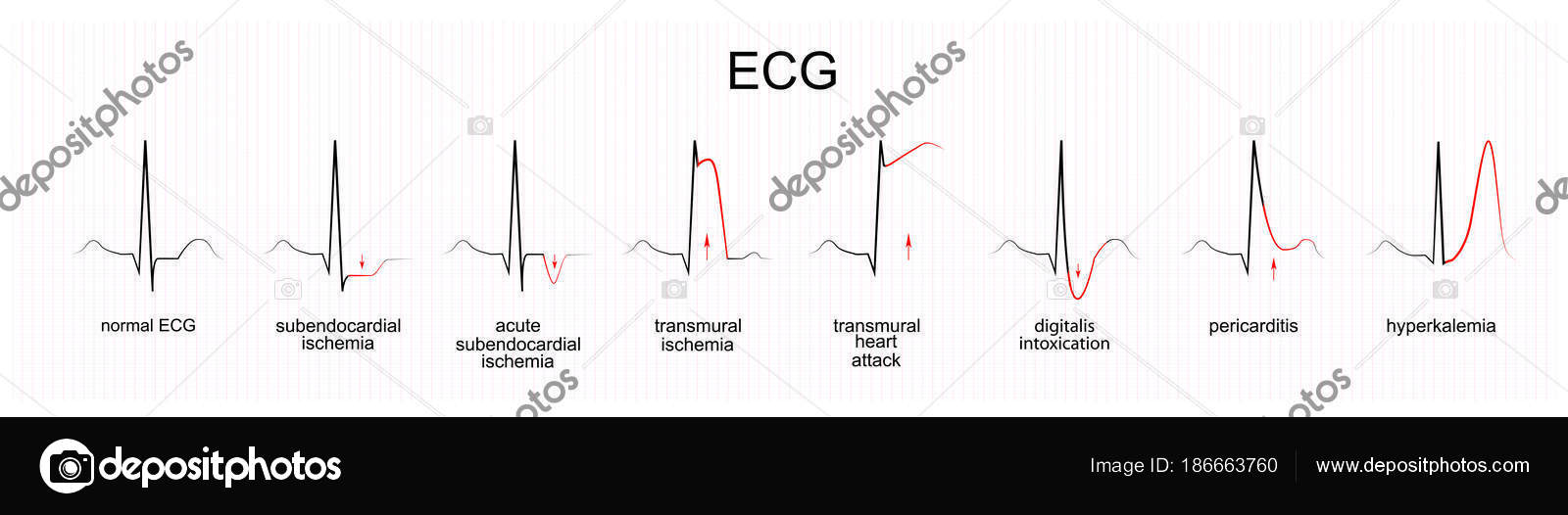 Interpretación del ECG Vector de stock por ©Artemida-psy 186663760