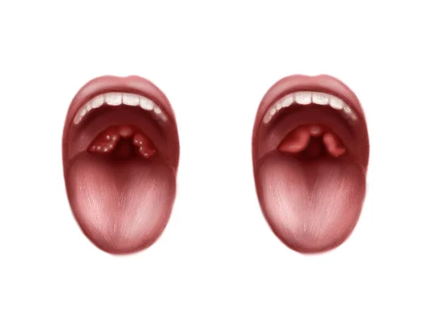 Quinsy Pictures, Quinsy Stock Photos & Images | Depositphotos®