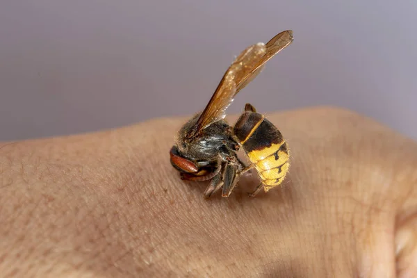 Hornet Bites Mans Hand Hornet Bites Mans Hand White Background Stock ...