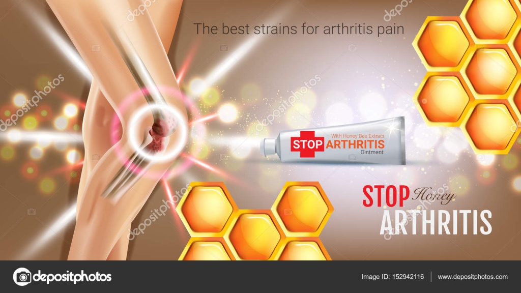 Arthritis Pain Relief Ointment ads. Vector 3d Illustration with Tube ...