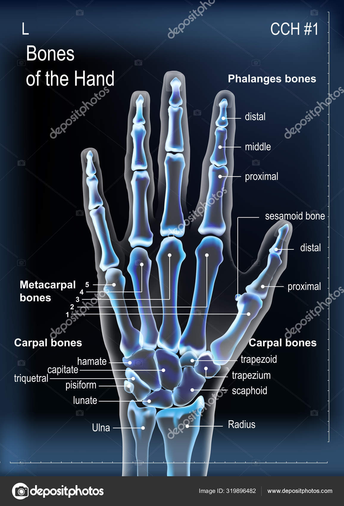 Frontal view x ray of bones the of hand with anotations. Stock Vector ...