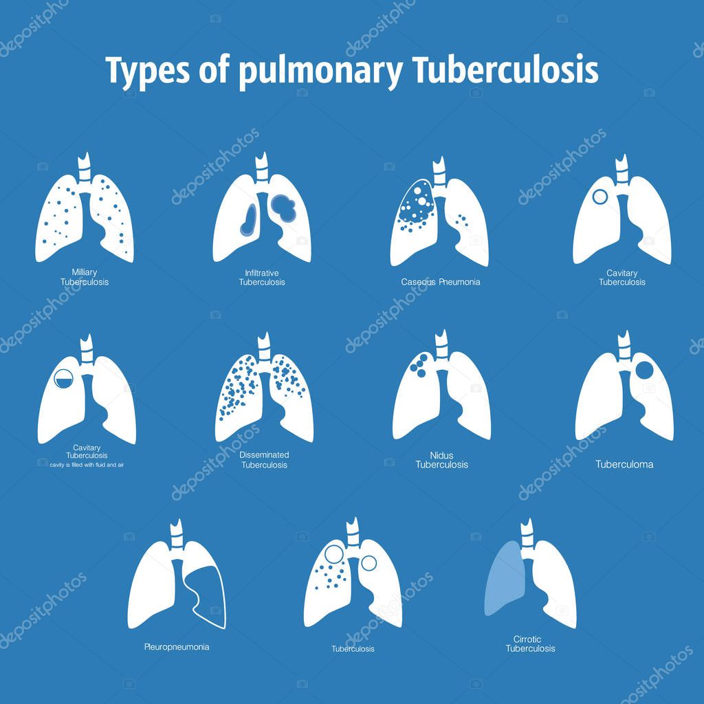 Types of tuberculosis. Vector silhouette medical illustration of human ...