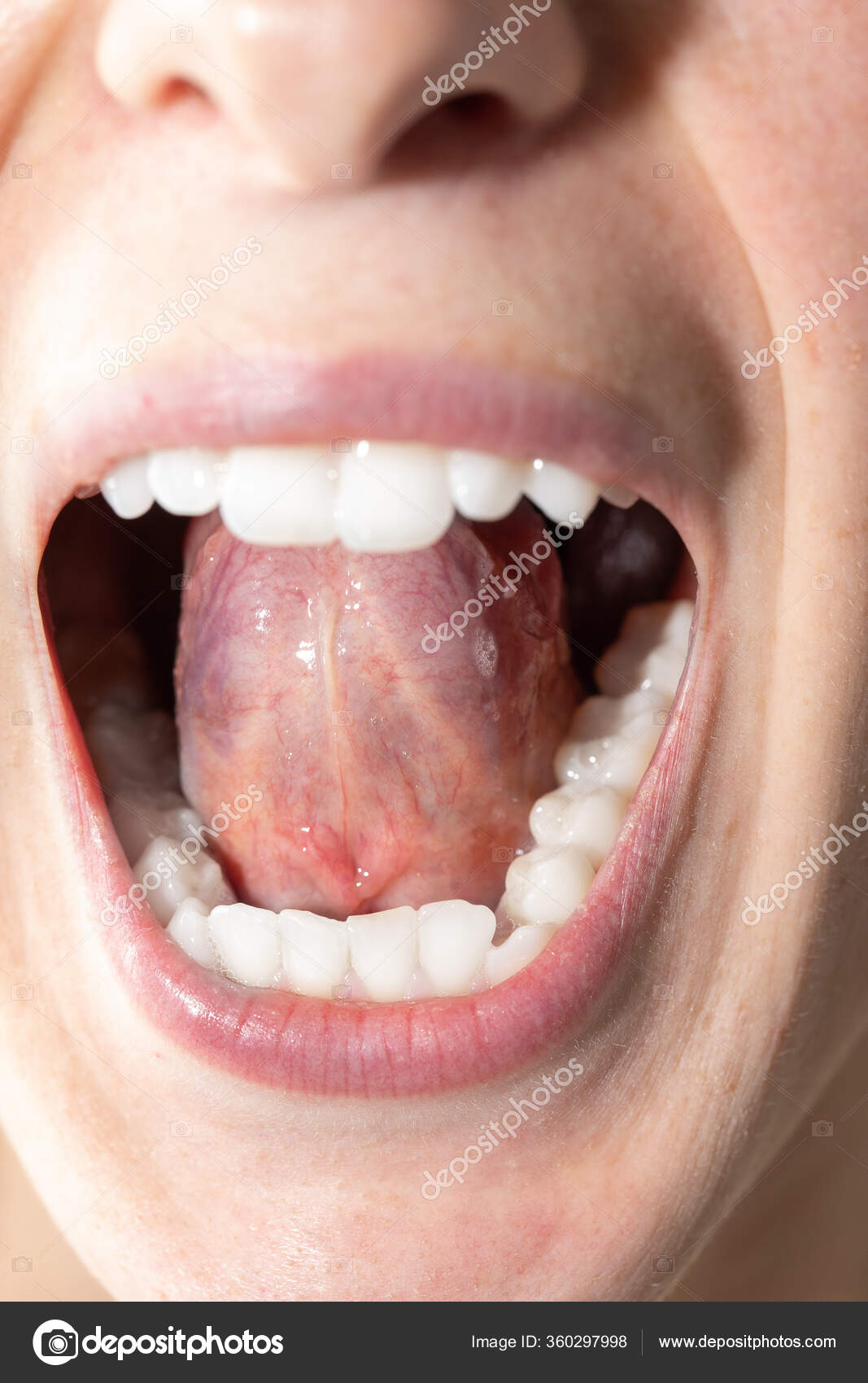 Healthy Tongue Underside
