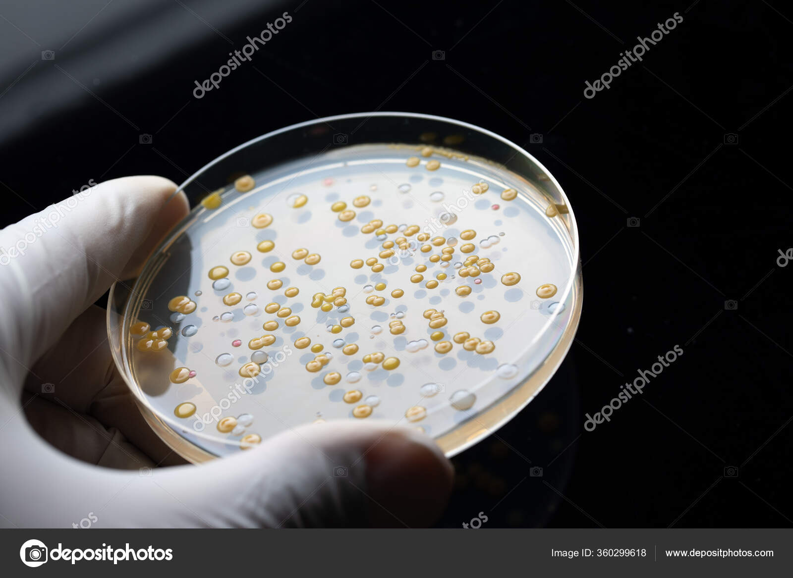Petri Dish Bacteria Identification