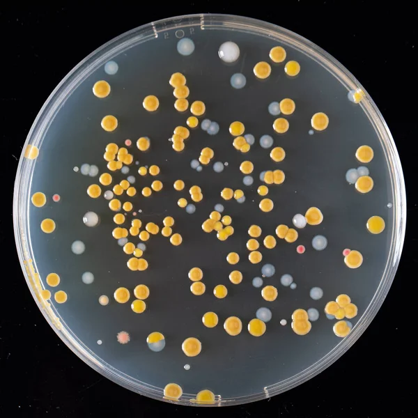 Agar culture of various bacteria on agar in a Petri dish - Stock Image - Everypixel
