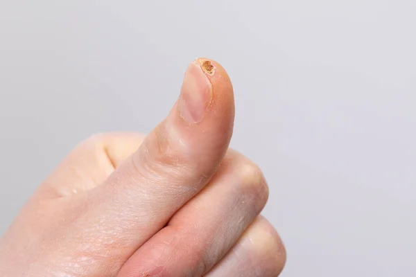 Neutral thumb Stock Photos, Royalty Free Neutral thumb Images ...