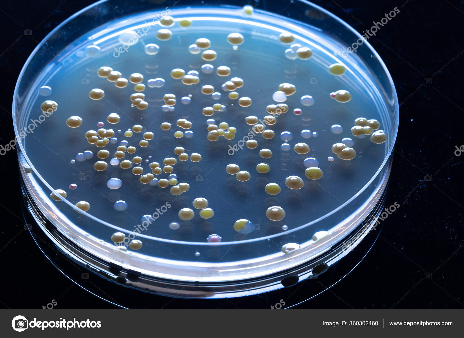 Petri Dish Bacteria Identification