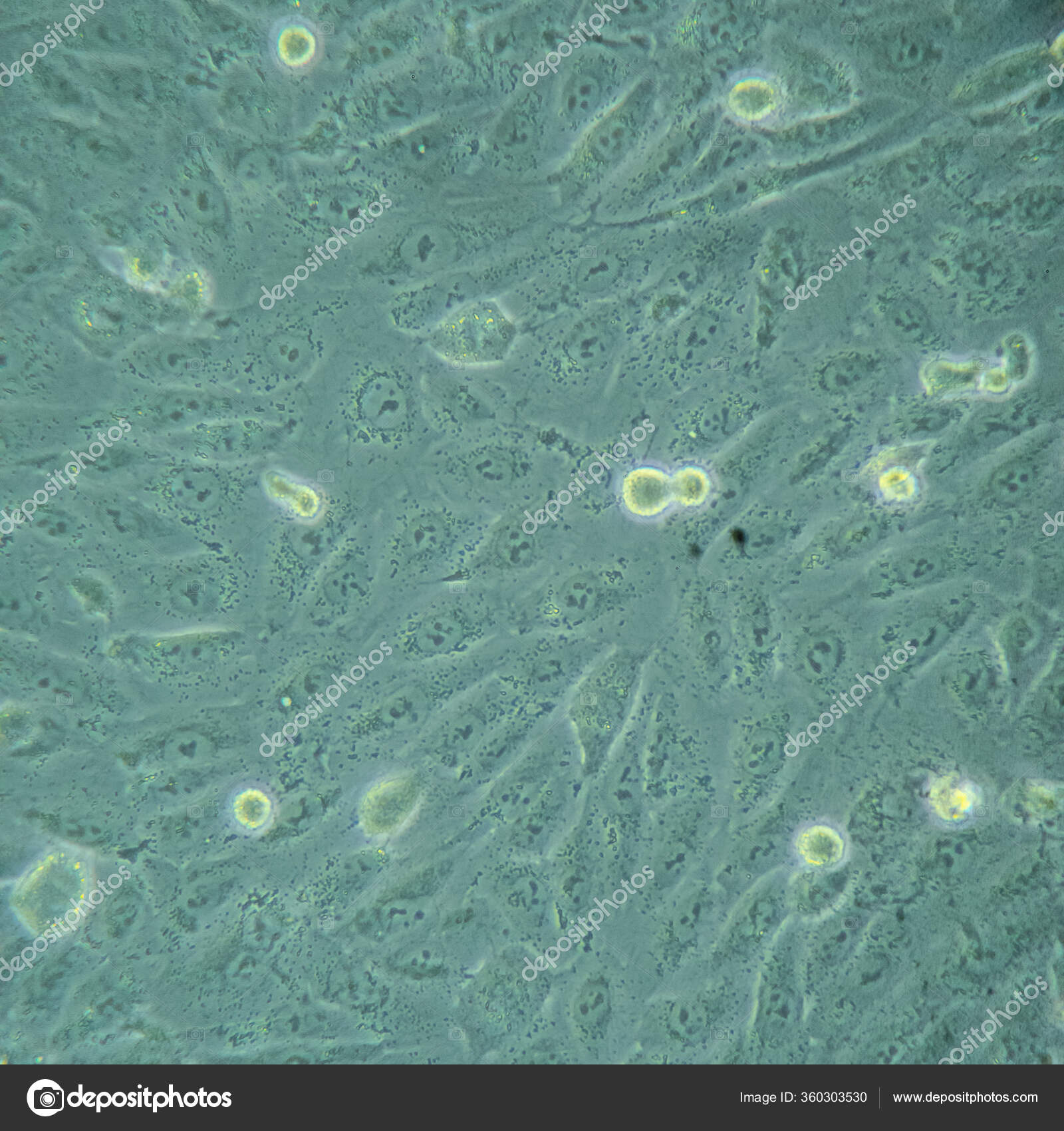 Bacteria Colony Growing Petri Dish Microsope — Stock Photo © sruilk ...