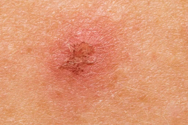 Details Human Skin Seen Extreme Detail Blurred Edges Focused Circle ...