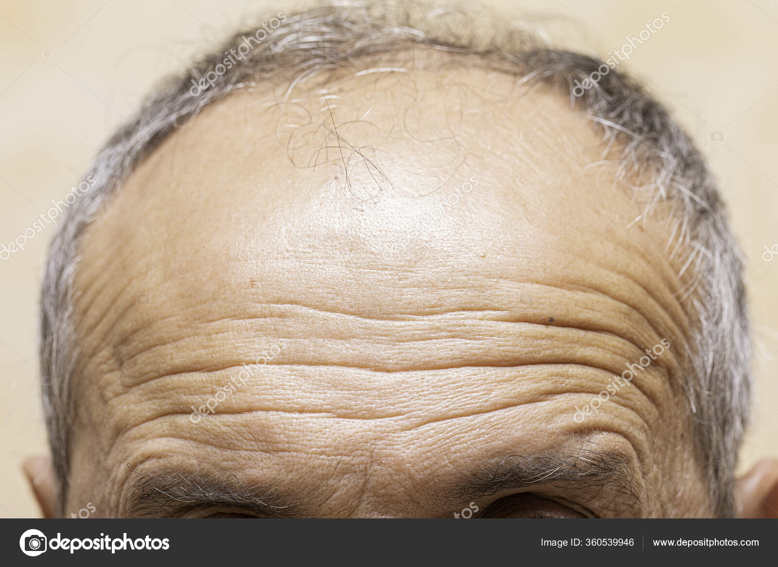 Old Wrinkled Forehead