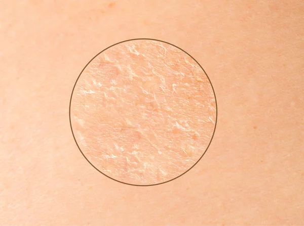 Human skin detail Images - Search Images on Everypixel