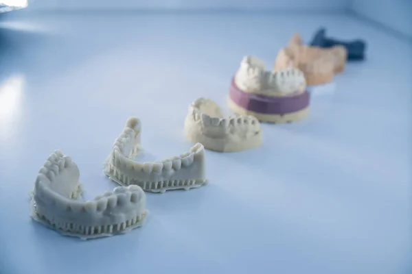Set Dental Casts Stock Photo by ©DenisSmile 185683250