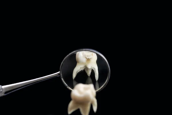 bad rotten tooth is pulled out and is located opposite the denta ...