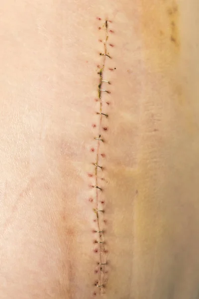 A wound on the skin Stock Photo by ©CatherineL-Prod 141136214