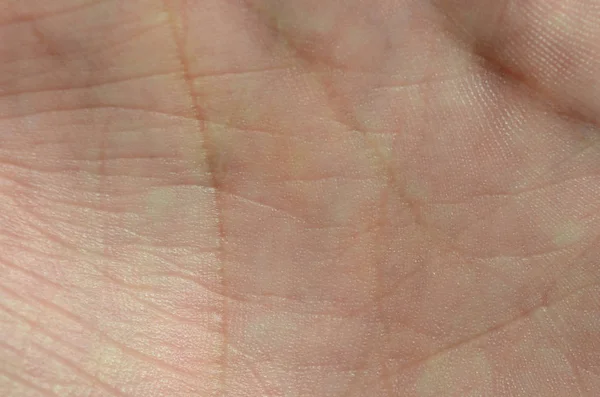 Human skin — Stock Photo © deposit123 #2233805