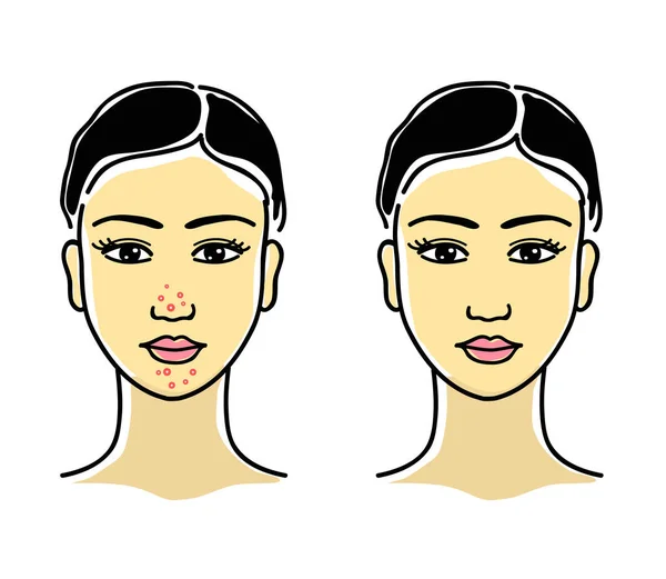 Penyakit dermatologi Vektor Stok, Ilustrasi Penyakit dermatologi Bebas ...