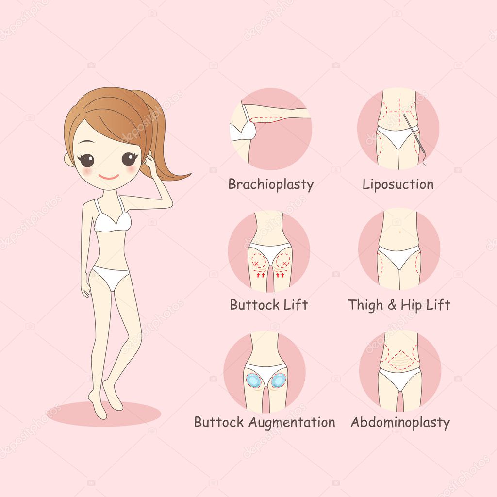 Cartoon Woman Body Plastic Surgery Stock Vector Image By ©etoileark