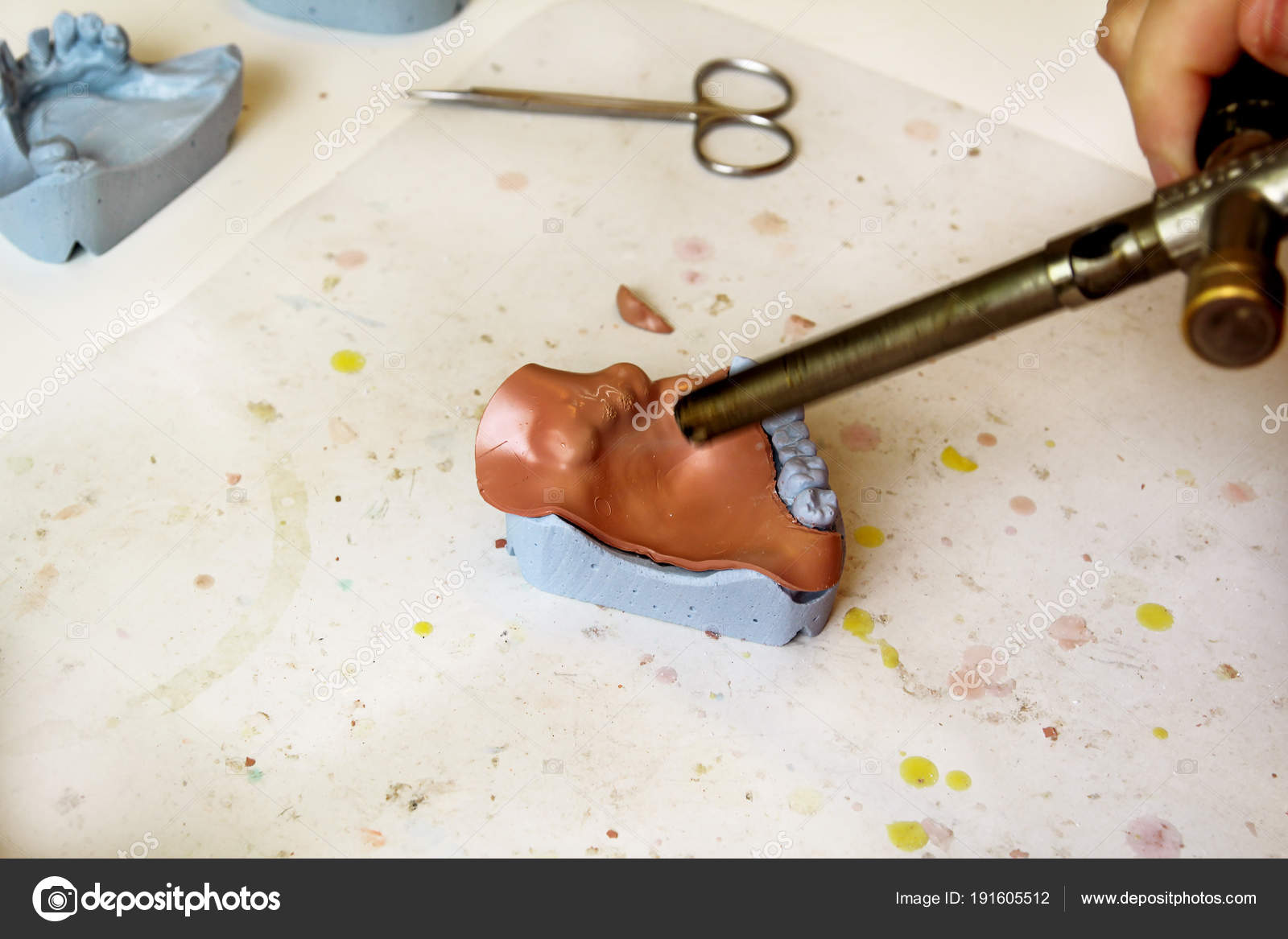 Warming of Shellac base plates over the plaster model — Stock Photo ...