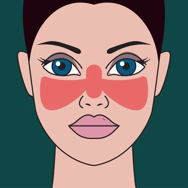 164 Systemic lupus erythematosus Vector Images, Systemic lupus ...