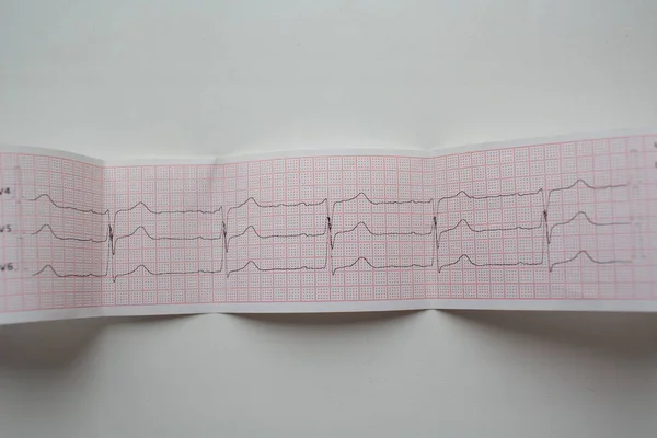 Ecg grossesse Stock Photos, Royalty Free Ecg grossesse Images ...