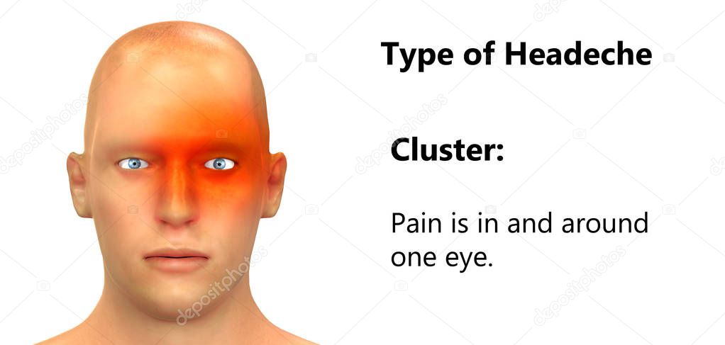 Cefalea humana Tipos de Anatomía (Cluster). 3D Ilustración 2022