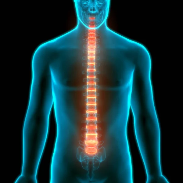 Thoracic arthritis Stock Photos, Royalty Free Thoracic arthritis Images ...