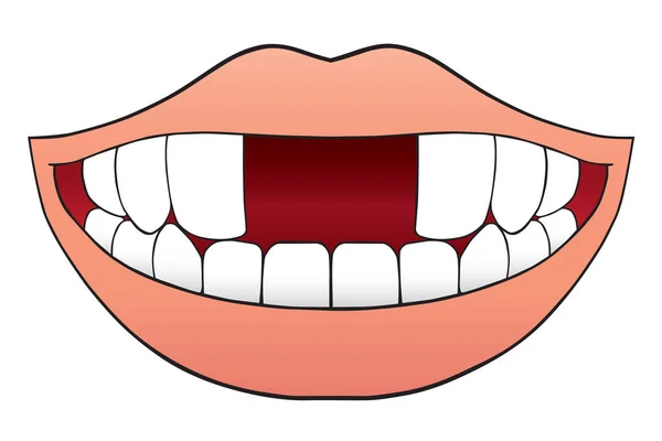 Missing teeth Vector Art Stock Images | Depositphotos