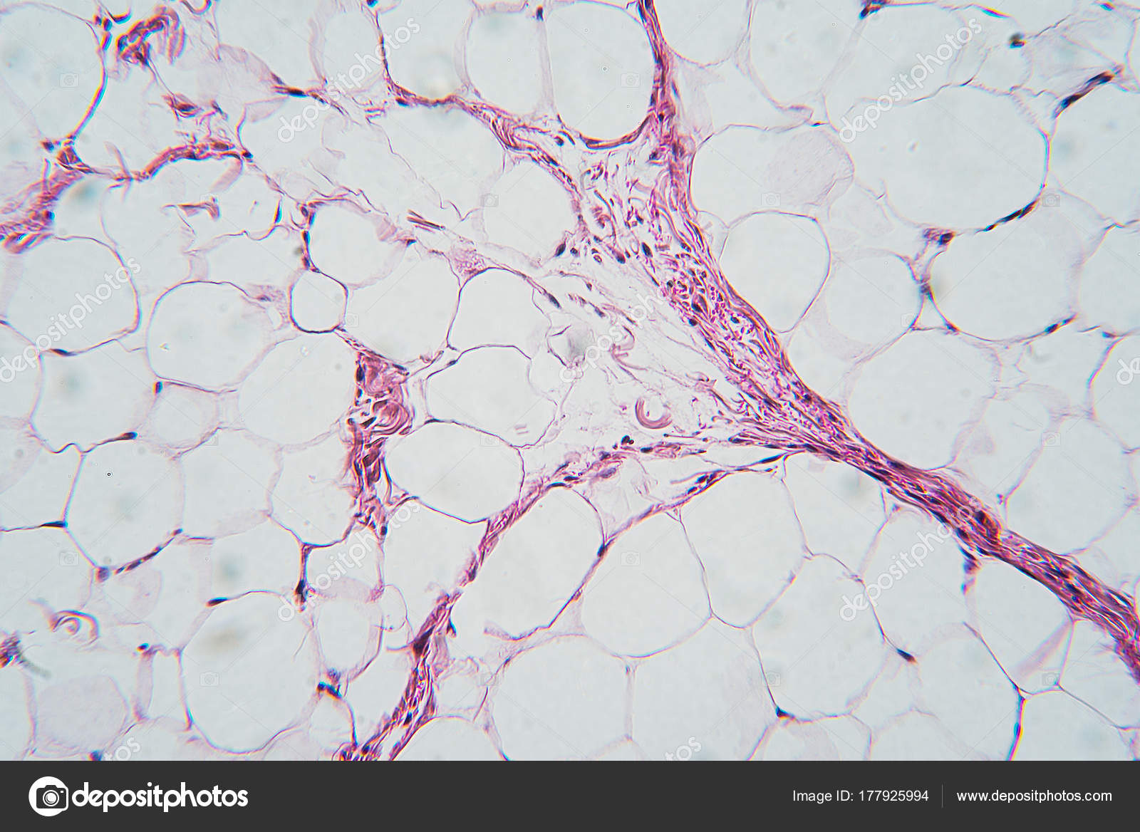 Breast Tissue Section Microscopic Image Stock Photo by ©microgen 177925994