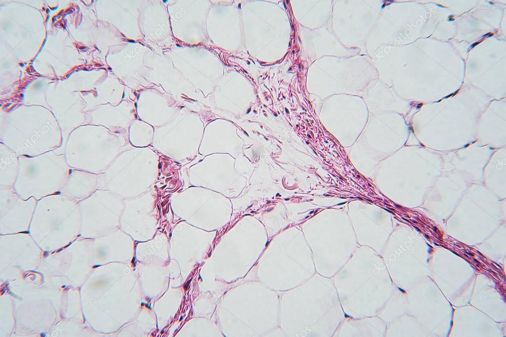 Breast Tissue Section Microscopic Image — Stock Photo © microgen #177925994