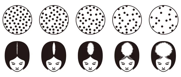 39 Female pattern baldness Vector Images | Depositphotos