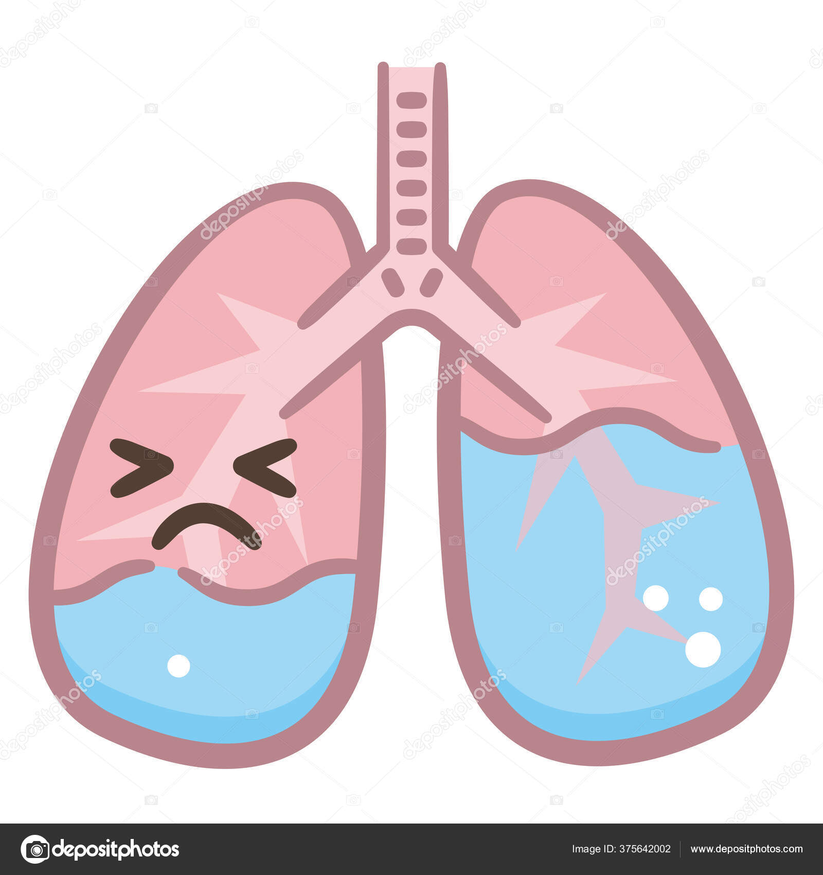 Edema Pulmonar Diagrama Enfermedad Pulmonar Con Bronquios Fuga Líquido ...