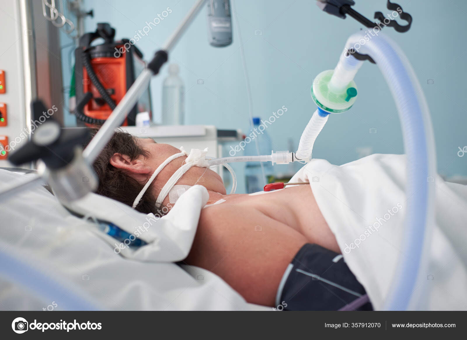 Intubated Woman Ventilator Assisted Breathing Due Flu Coronavirus ...