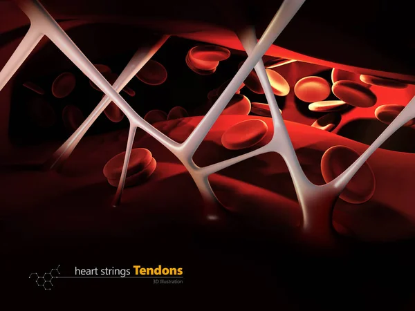 Illustration Illustration Blood Clot Thrombus Embolus Coagulated Red ...