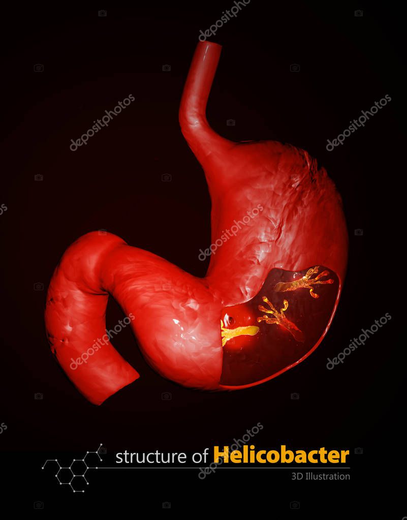 Helicobacter Pylori, bacteria microaerof lica que se encuentra en el ...