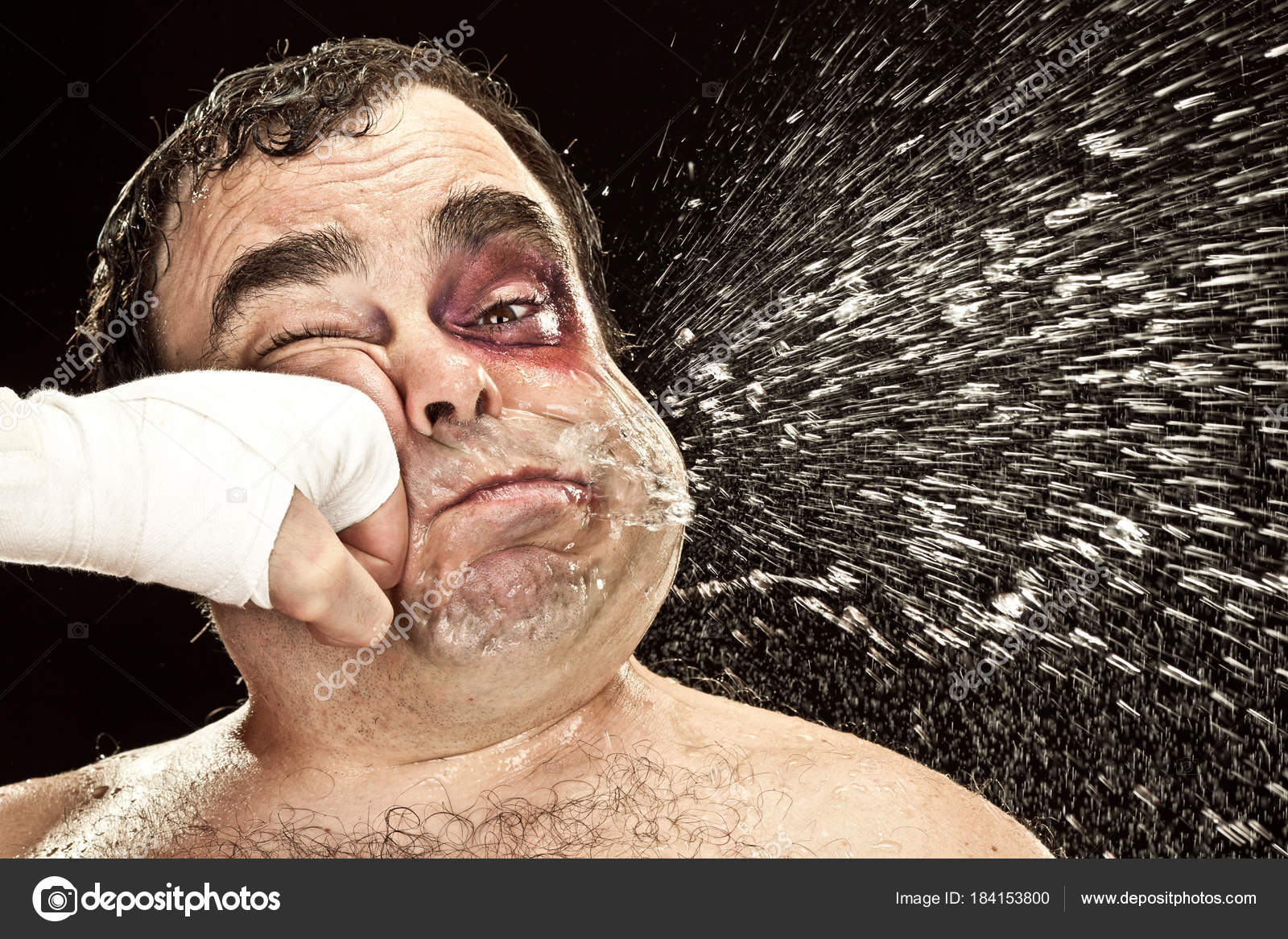 Black eye wound boxer spit due big punch hit portrait Stock Photo by ...
