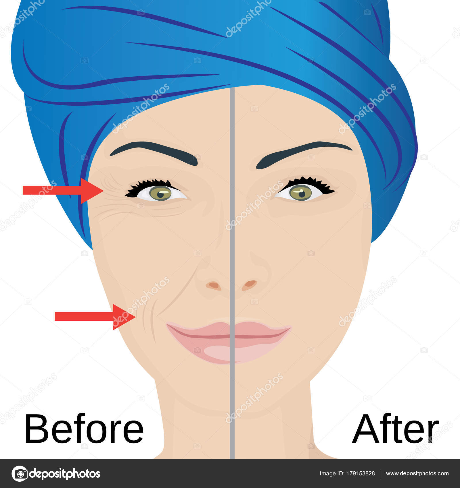 Aging face treatment. Before and after — Stock Vector © crazy ... Aging face treatment. Before and after — Stock Vector © crazy ...
