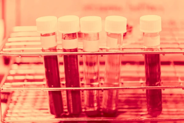 Blood group analysis Stock Photos, Royalty Free Blood group analysis ...