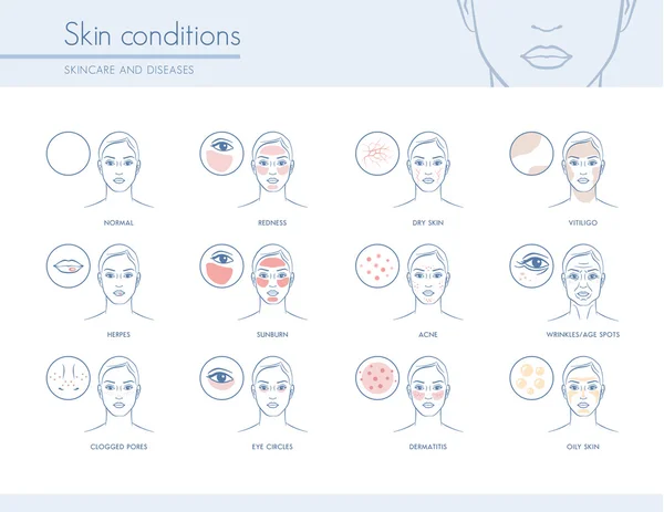 Skin conditions Stock Vectors, Royalty Free Skin conditions ...
